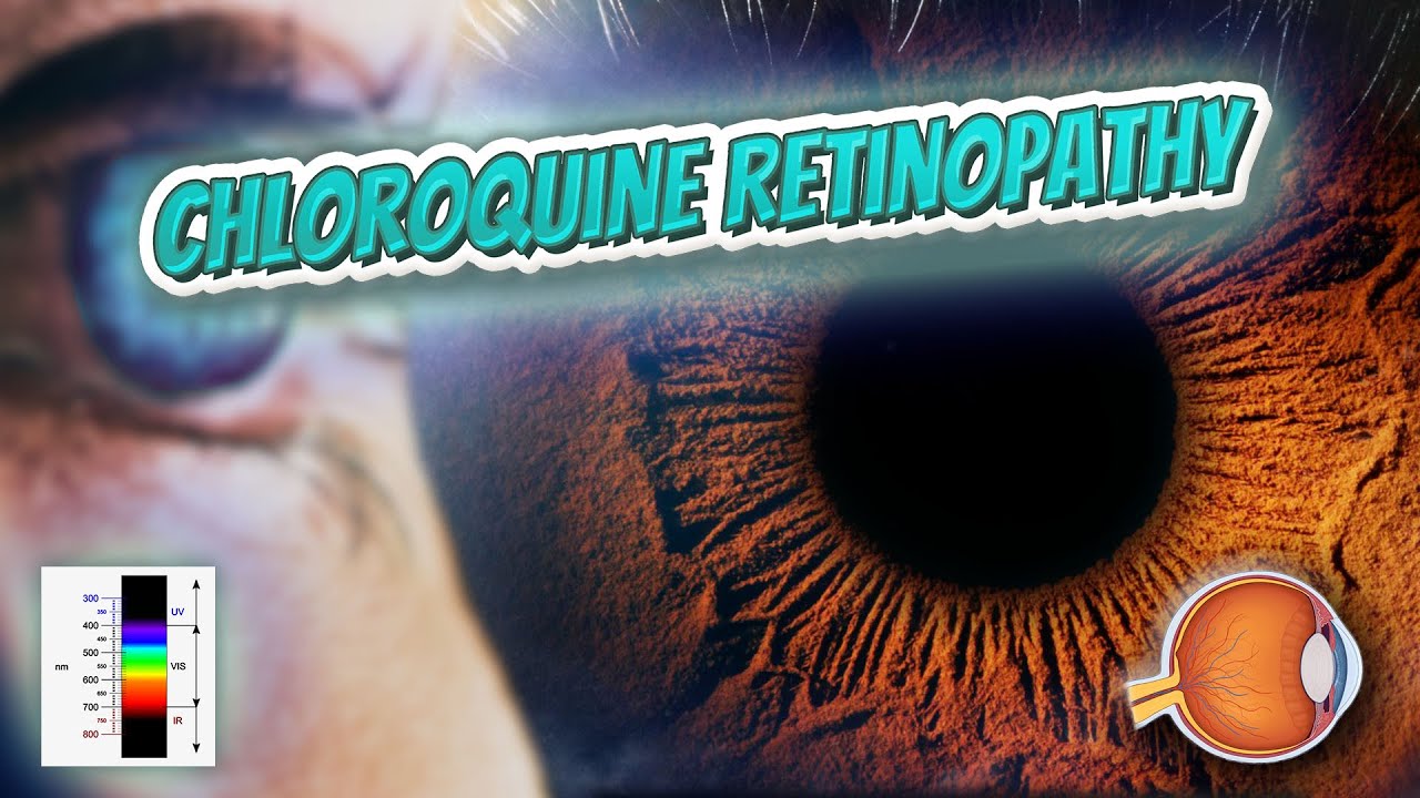 Chloroquine retinopathy - Your EYEBALLS - EYNTK 👁️👁️💉😳💊🔊💯 - YouTube