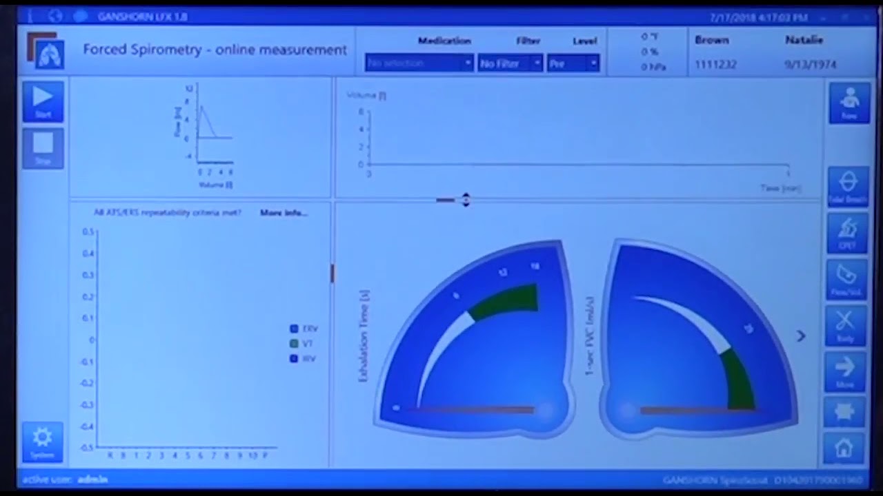 SCHILLER Spiroscout Basic Usage Tutorial - YouTube
