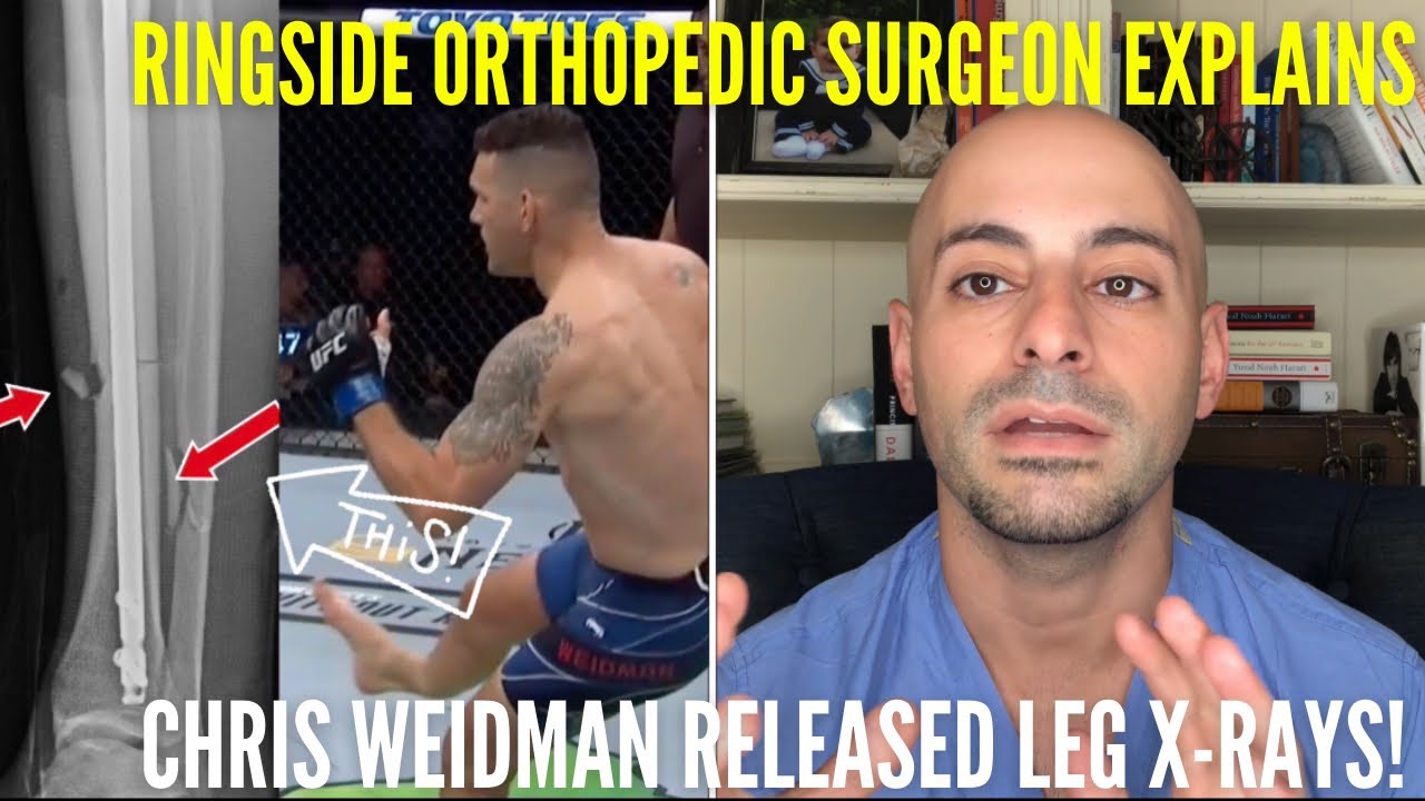 Ortho Surgeon of UFC Fighters EXPLAINS Chris Weidman’s LEG X-RAYS‼️ ...
