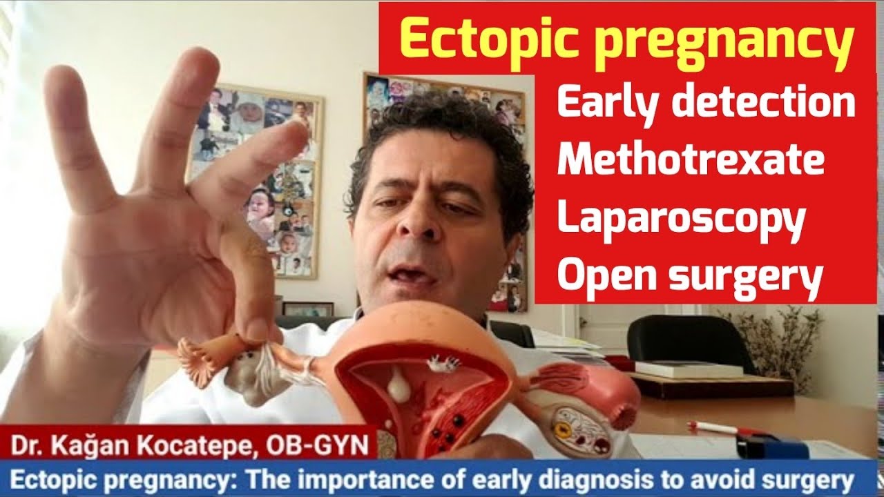 Ectopic pregnancy. Early detection and treatment options. Methotrexate ...