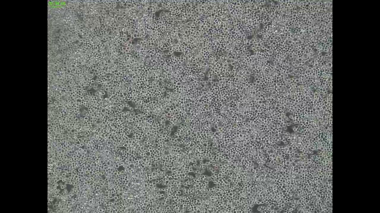 Bacmid transfection & virus propagation - YouTube