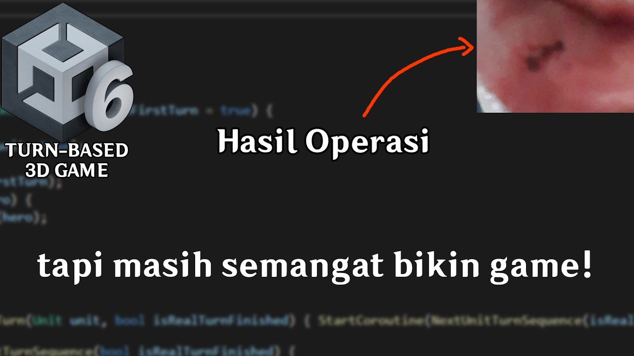 【Coding Stream】Game turn-basednya banyak progress setelah selesai operasi hehe - YouTube