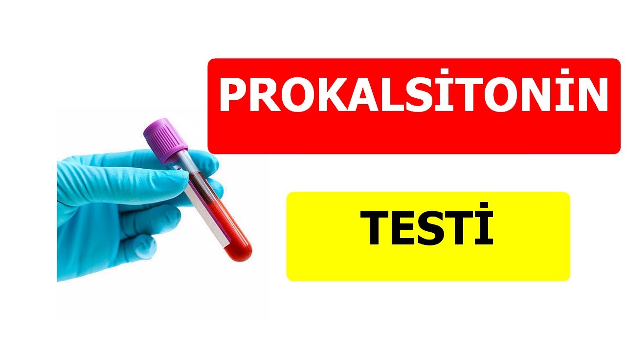 PROKALSİTONİN (PCT) TESTİ NEDİR ? - YouTube