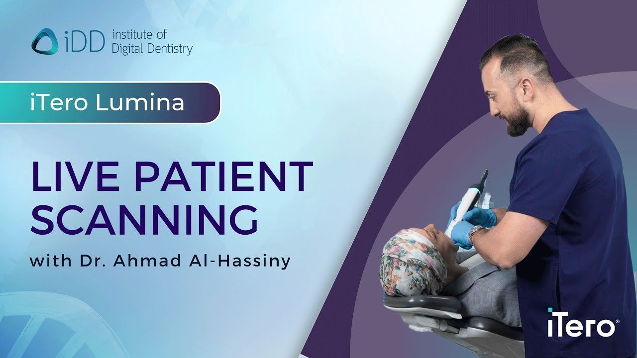 iTero Lumina Intraoral Scanner - Live Patient Full Arch Scanning ...