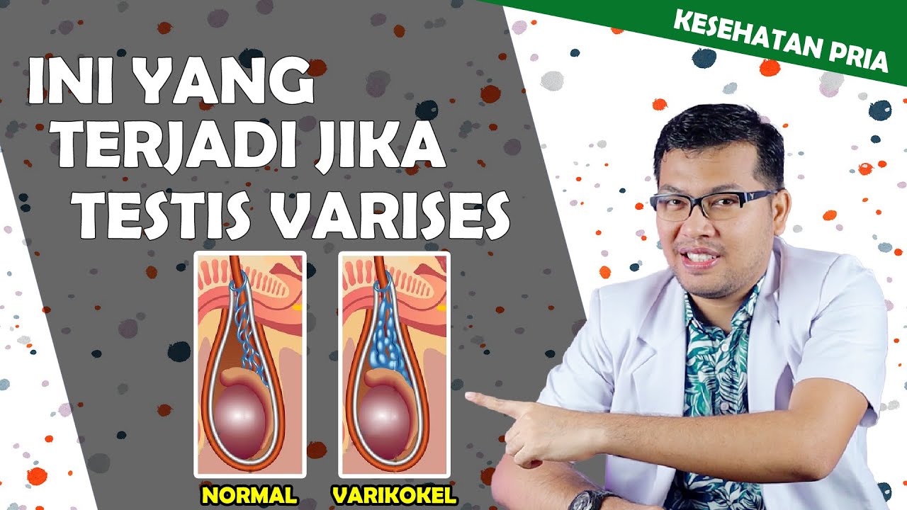 VARIKOKEL ATAU VARISES TESTIS - DOKTER SADDAM ISMAIL - YouTube