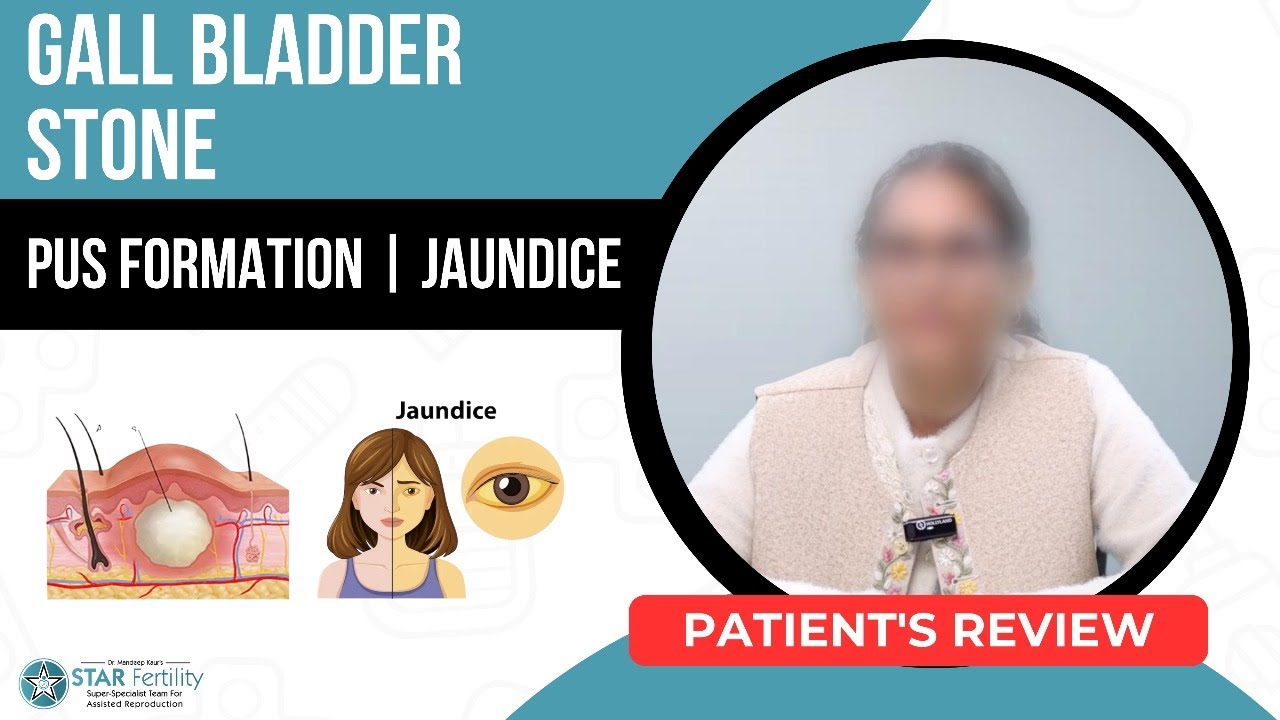 Best Hospital for Gall Bladder Stone in Kapurthala | Best Gall Bladder ...