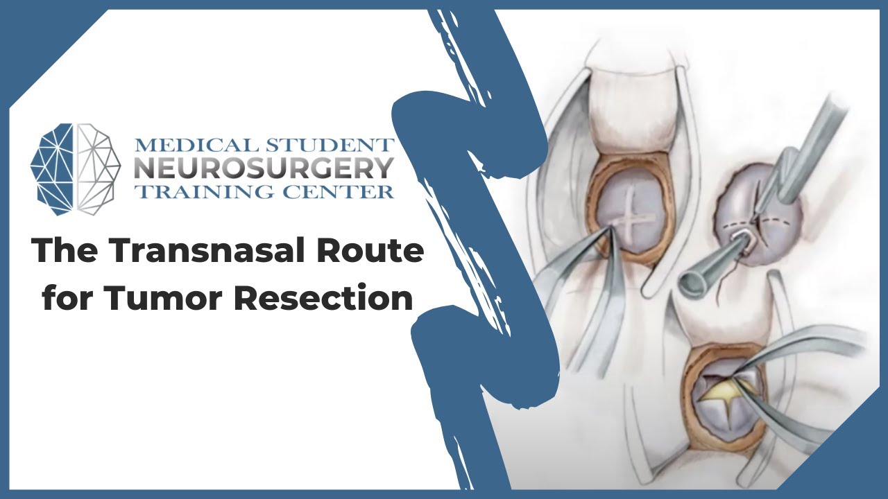 The Transnasal Route for Tumor Resection - YouTube