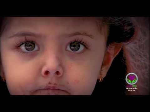 EB Patients In iran - EB home - YouTube