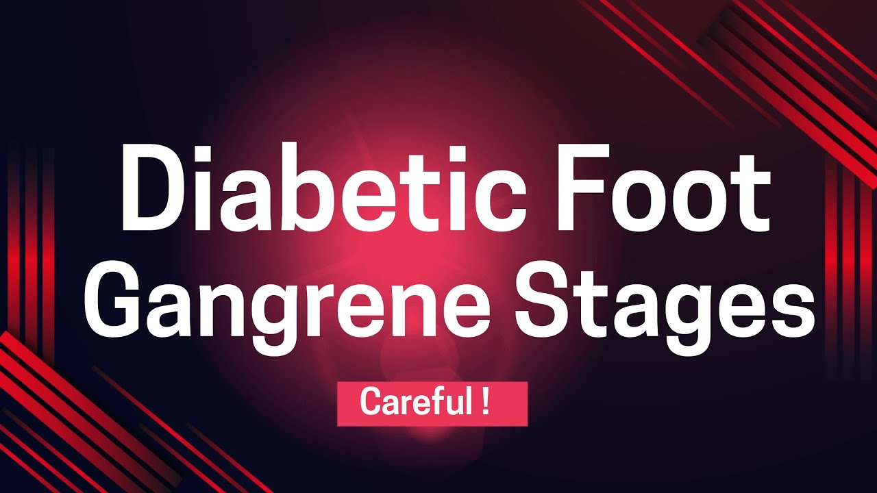 Diabetic Foot - Dysvascular Foot Breakdown Natural History #gangrene # ...