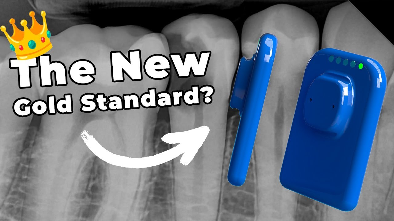 The New Gold Standard In Wireless Dental Sensors?? - YouTube