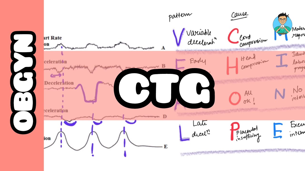Quick mnemonic for CTG (cardio topography) for USMLE, NEET PG, INICET ...