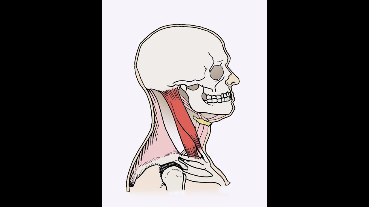 Sternocleidomastoid (SCM) exercise - YouTube