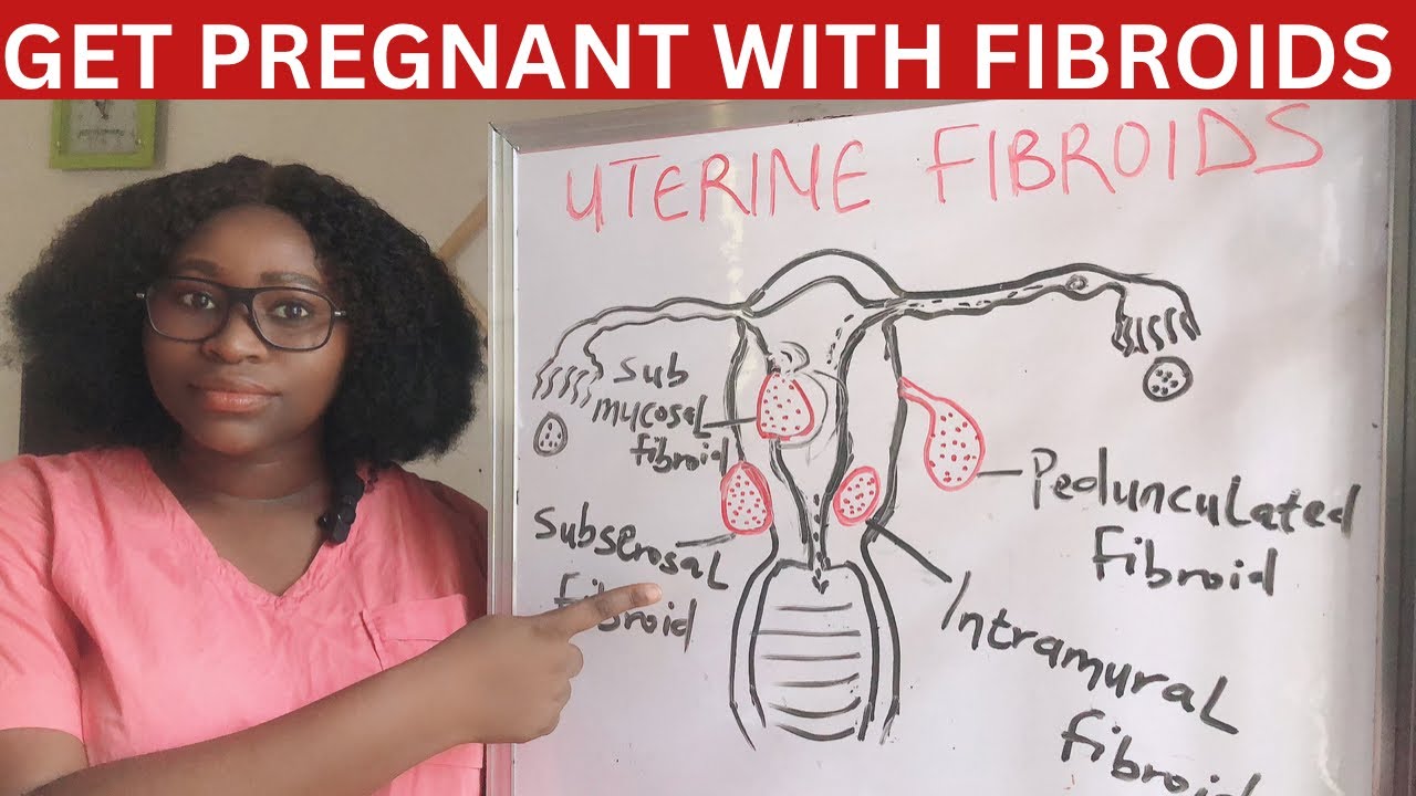 Uterine Fibroids ; Types, Causes, Symptoms & Treatment Of Uterine Fibroids - YouTube