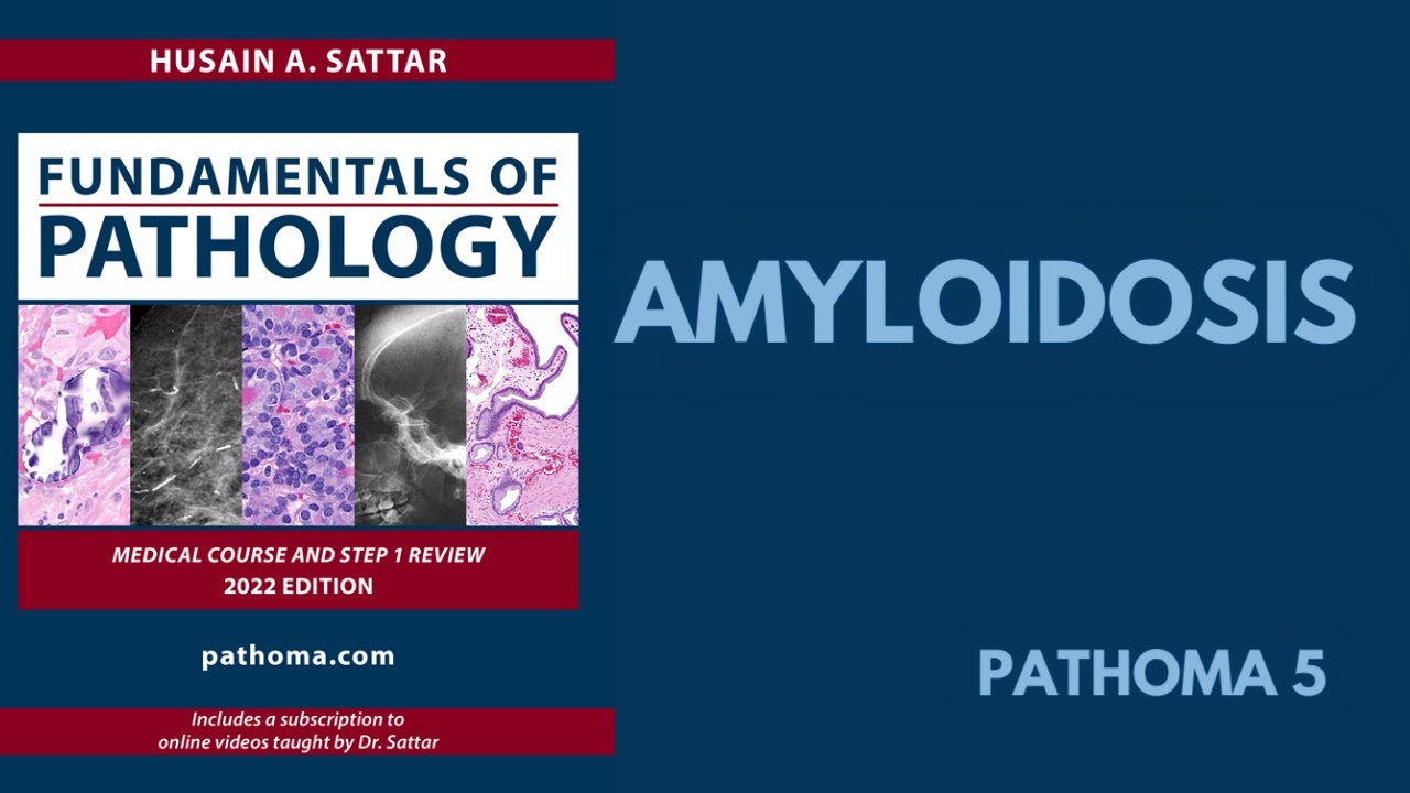 Amyloidosis ( Pathoma 5 ) - YouTube