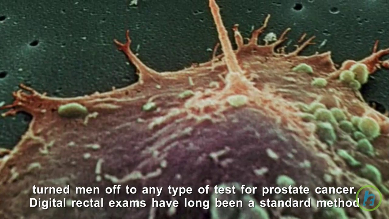 Digital Prostate Exam Accuracy - YouTube