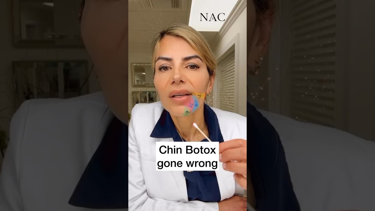 Chin Botox gone wrong #botox #badbotox #drbitafarrell - YouTube