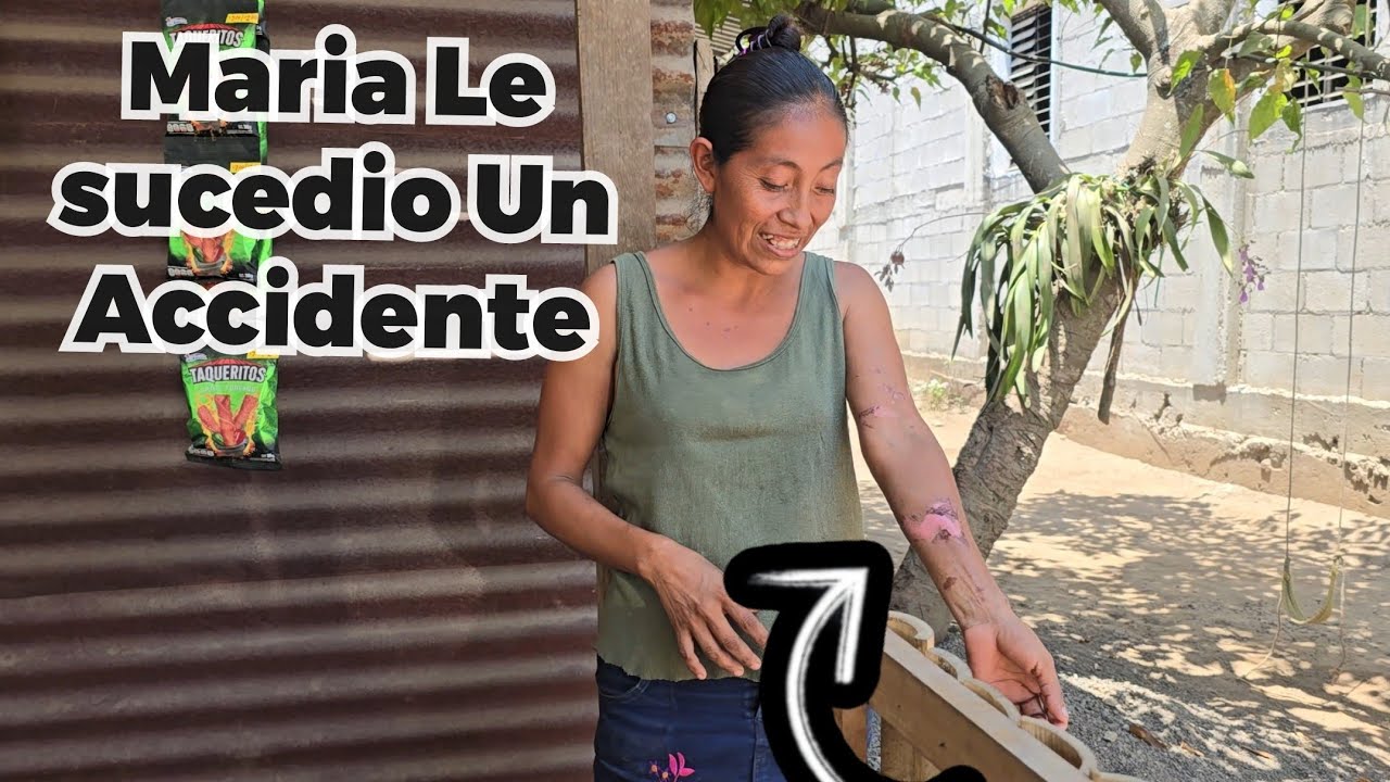 ¡Por DIOS! doña Maria Se Quema Todo el Brazo? - YouTube