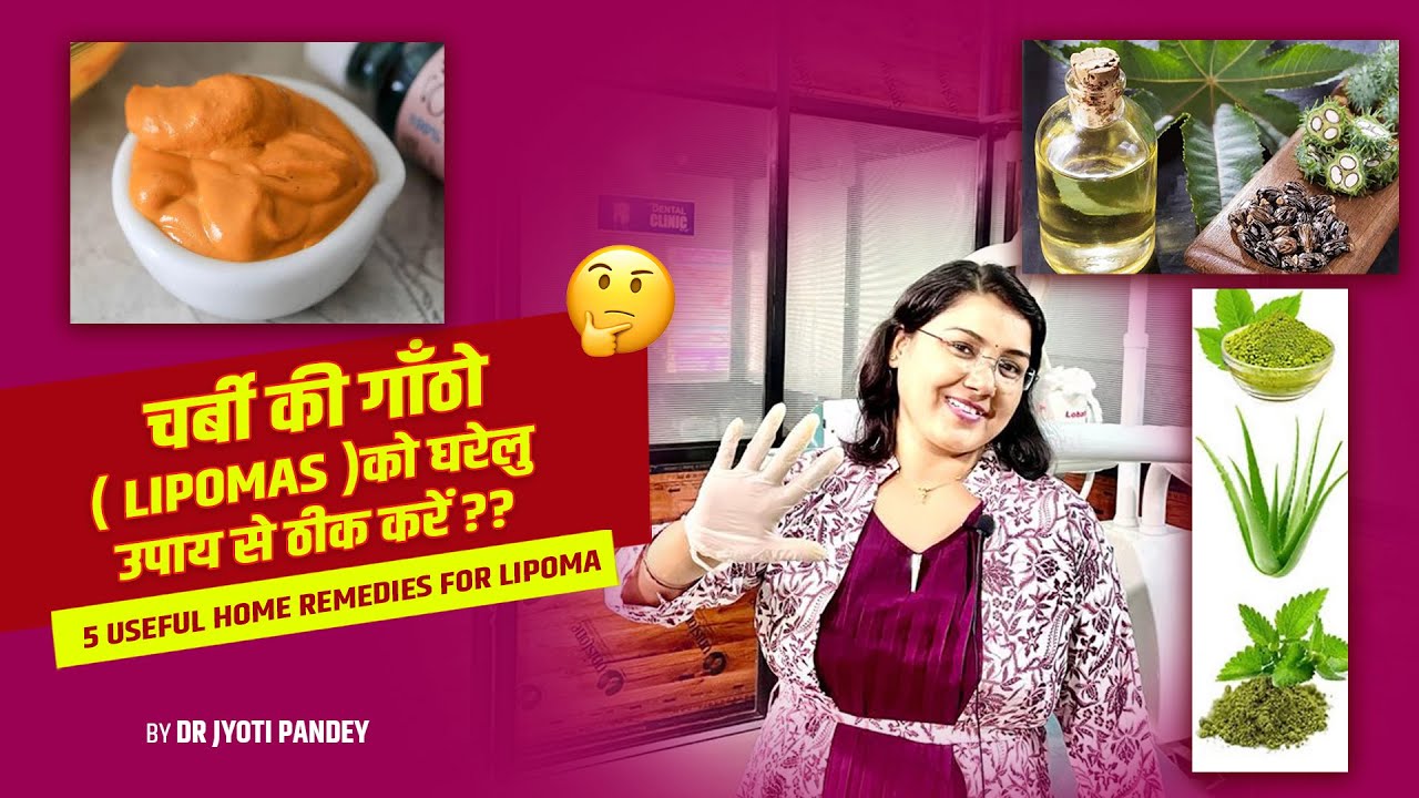 चर्बी की गाँठो( Lipomas )को घरेलु उपाय से ठीक करें || 5 useful Home ...