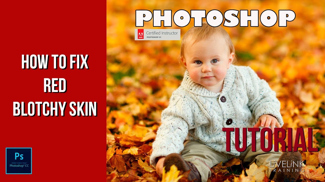 How To Fix Red Blotchy Skin Photoshop Tutorial YouTube how-to-fix-red-blotchy-skin-photoshop-tutorial-youtube