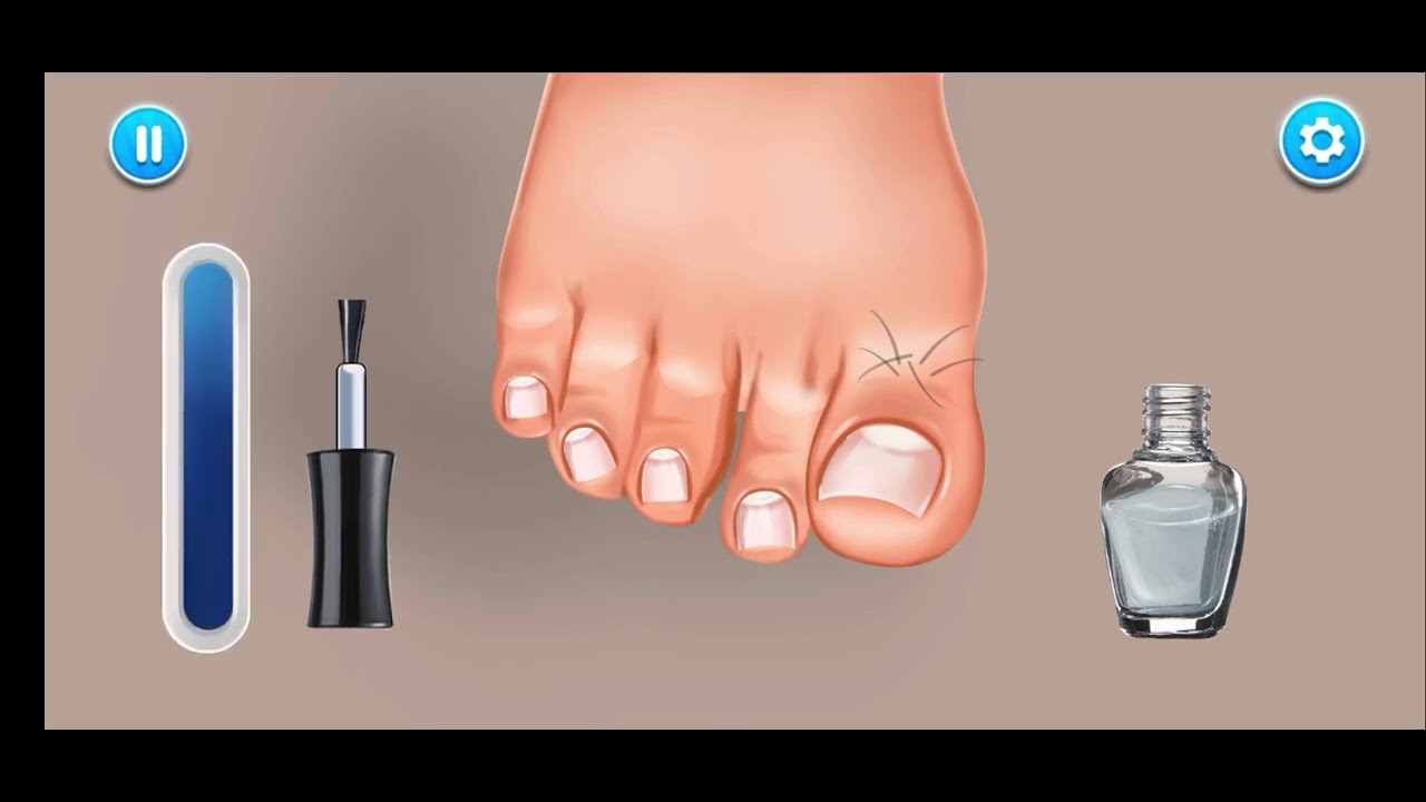 ASMR INGROWN TOENAIL | HOSPITAL DOCTOR ASMR GAME - YouTube