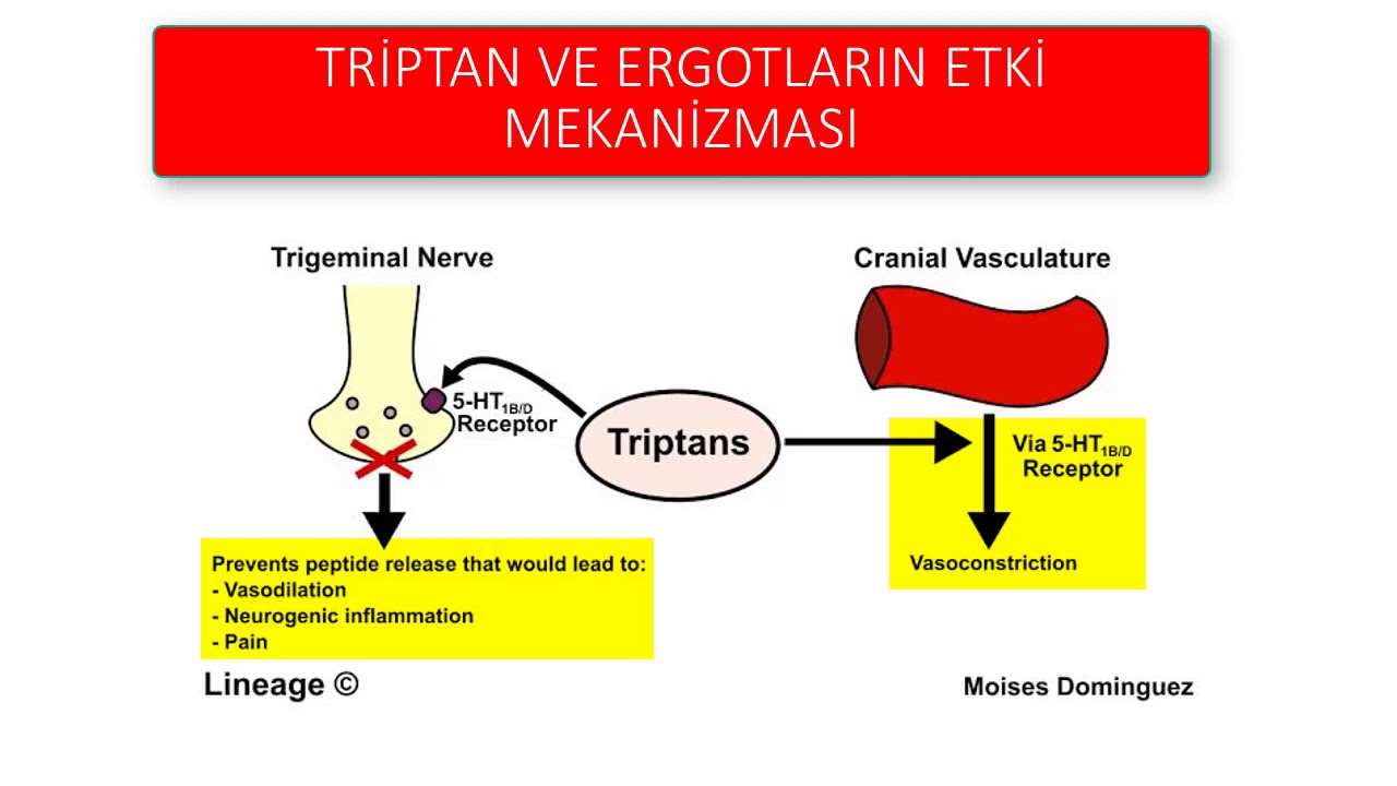 MİGREN TEDAVİSİ - YouTube