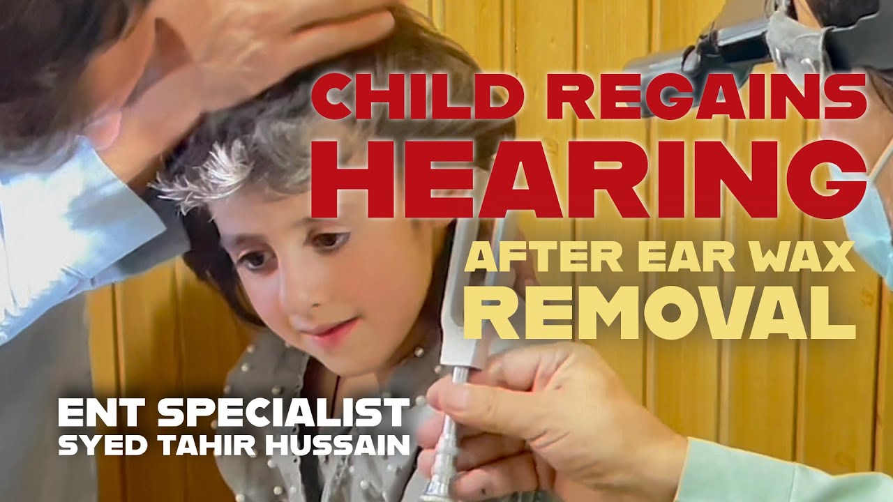 Young Child Patiently Undergoes Ear Wax Removal to Restore Hearing ...