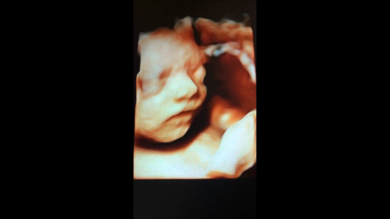 25 week 4D ultrasound. - YouTube