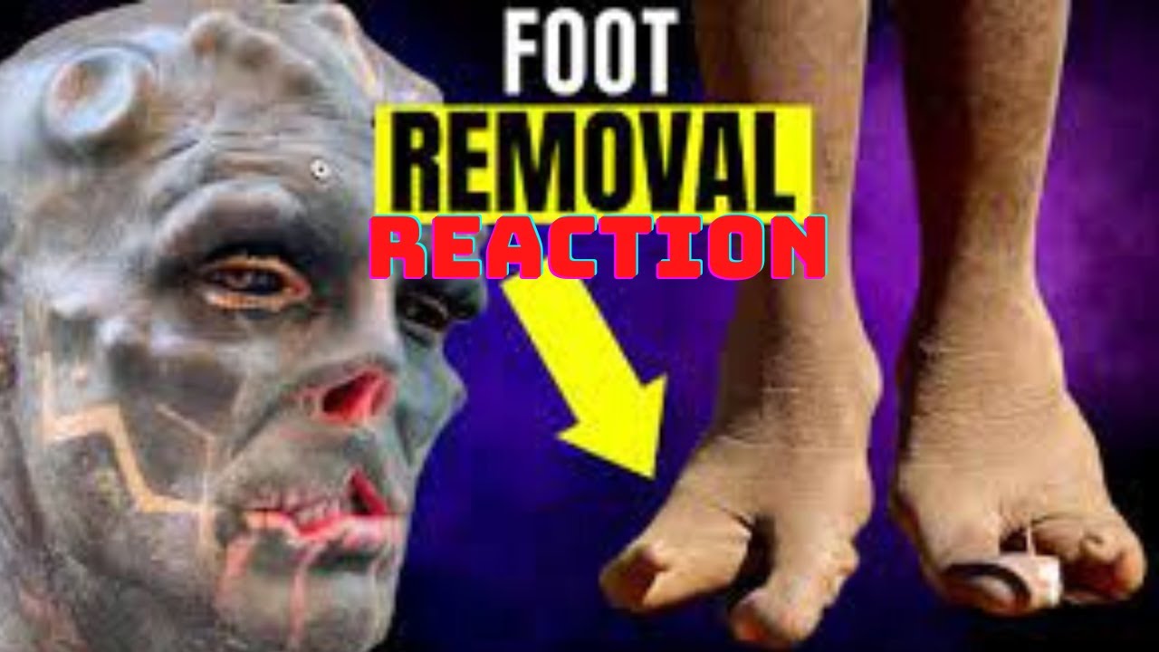 Black Alien Project Disturbing Foot Modification (This Will Ruin His ...