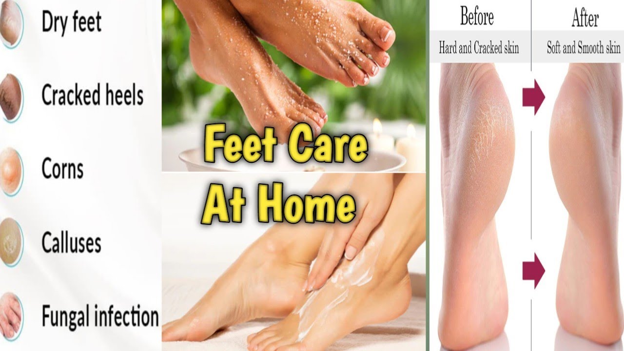 Feet Care At Home | गर्मी में इस तरह करें पैरों की देखभाल | Tips to ...