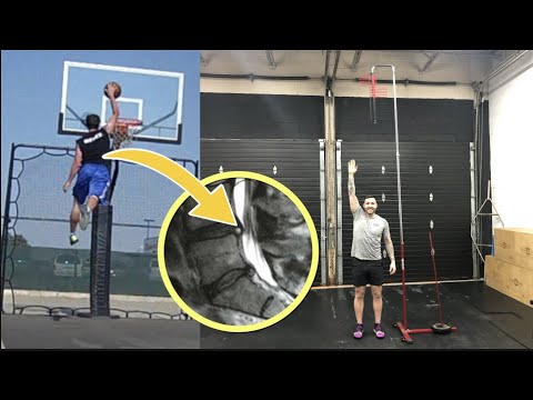 48" VERTICAL JUMP to HARDLY WALKING and BACK AGAIN at 37-YEARS-OLD ...