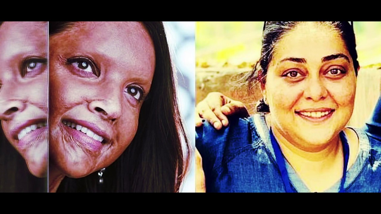 Movie Review - Chappak || Why Chappak and Deepika Padukone in ...