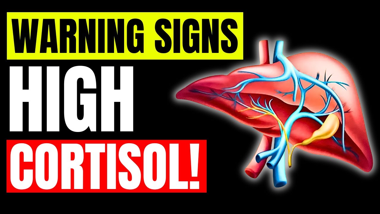 8 Warning Signs of High Cortisol (High STRESS) to NOT IGNORE | What ...