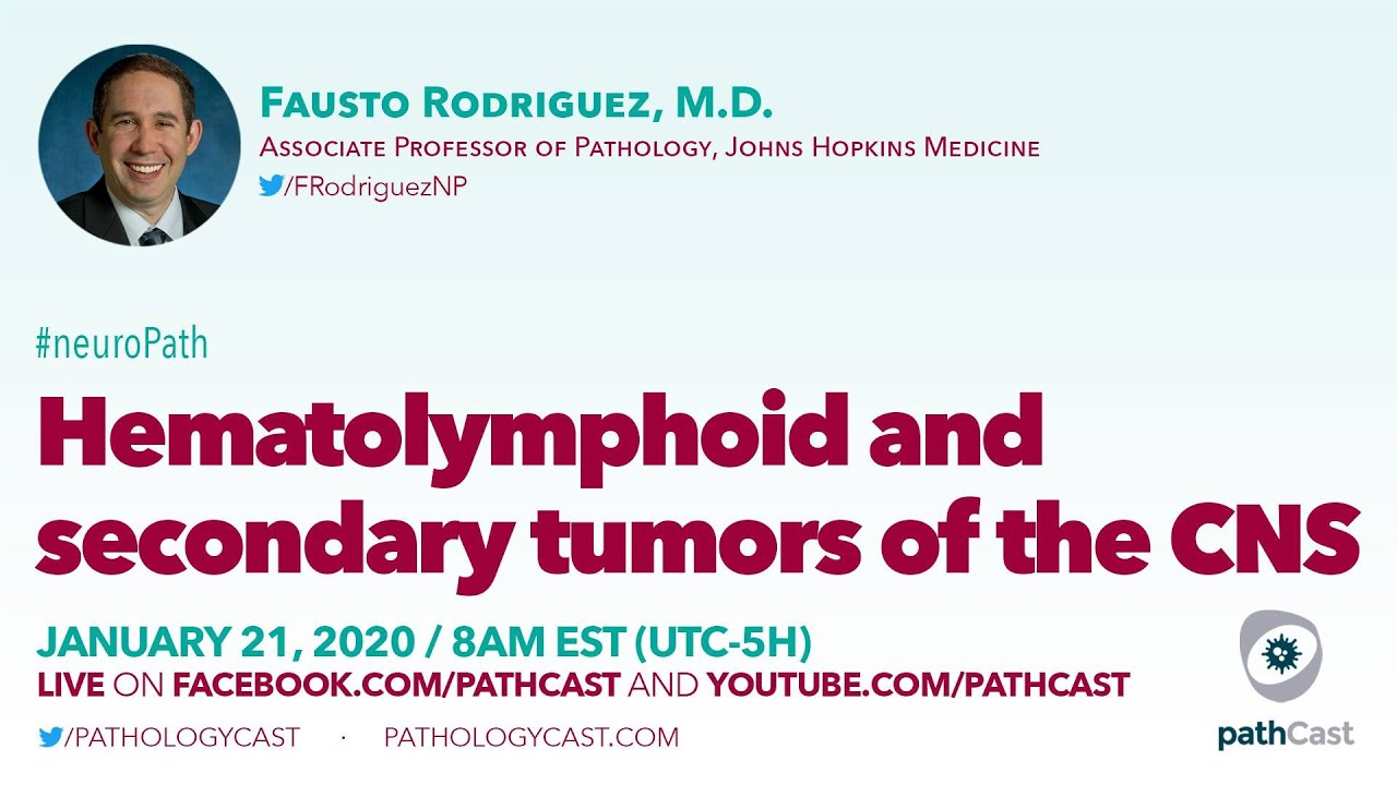 Hematolymphoid and secondary tumors of the CNS - Dr. Rodriguez (Hopkins ...