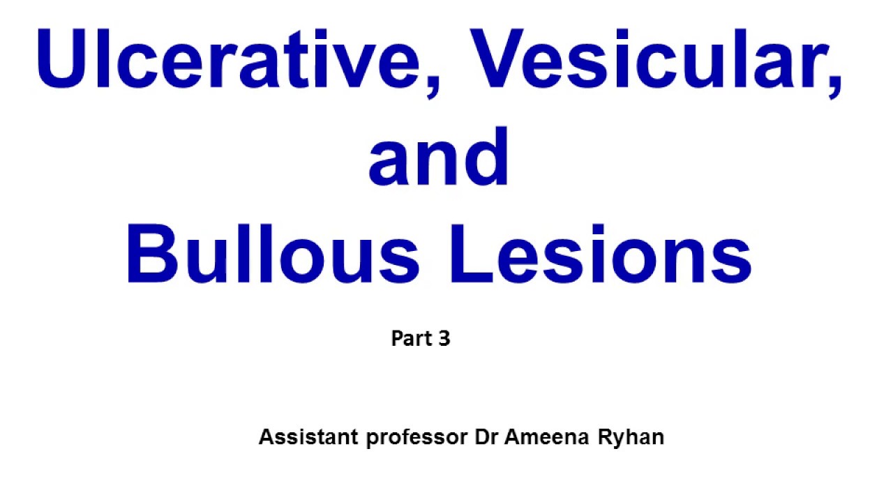 Ulcerative Vesicular Bullous Lesions 3 rd part - YouTube