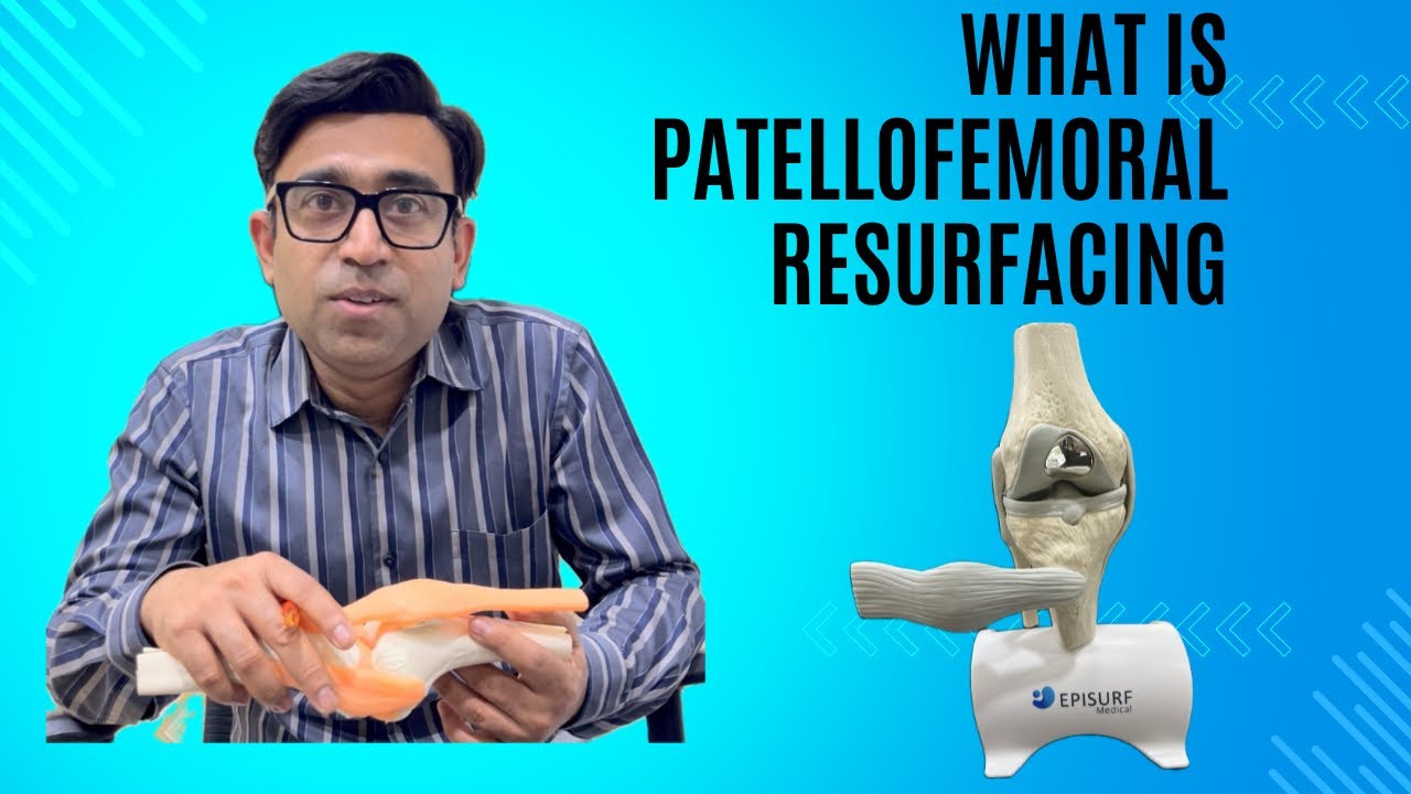 What do you understand by patellofemoral arthritis and patellofemoral ...
