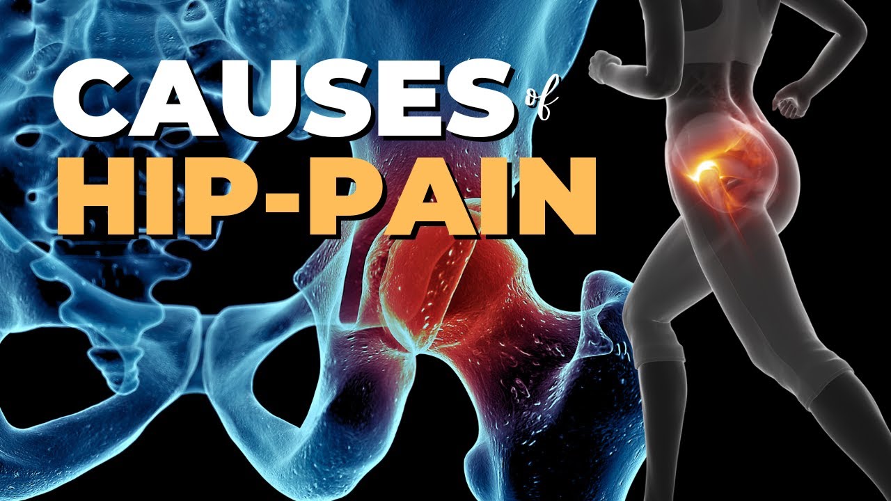 Understanding the 4 Main Causes of Hip Pain - YouTube