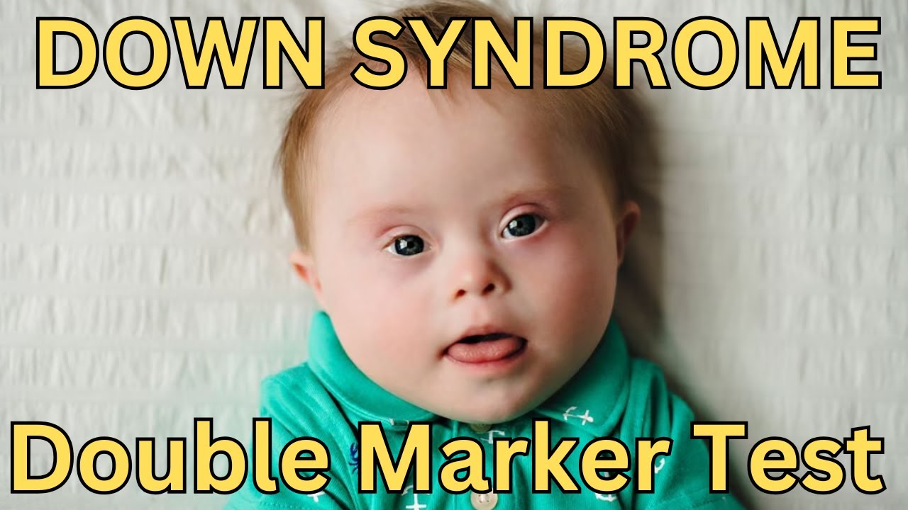 Double Marker Test | My story with full details @Kiaan1804 - YouTube