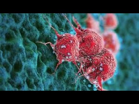 Skin Cancer Detection Using TensorFlow - YouTube