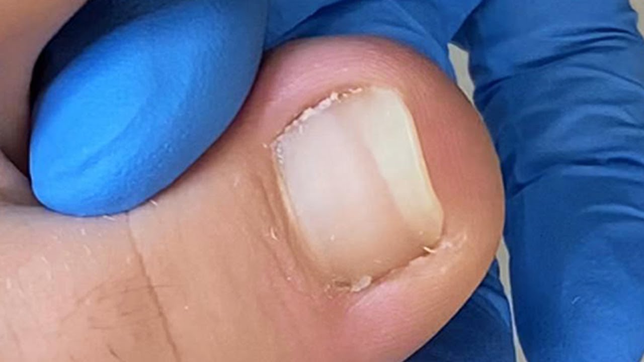 Deep clean for nails【Xue Yidao】 - YouTube