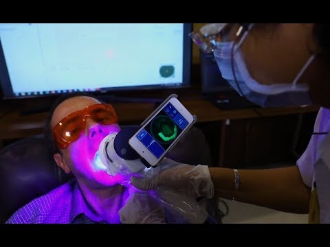 Dr  Kolte - VELscan Oral Exam and DNAscan (DNA Ploidy Test)