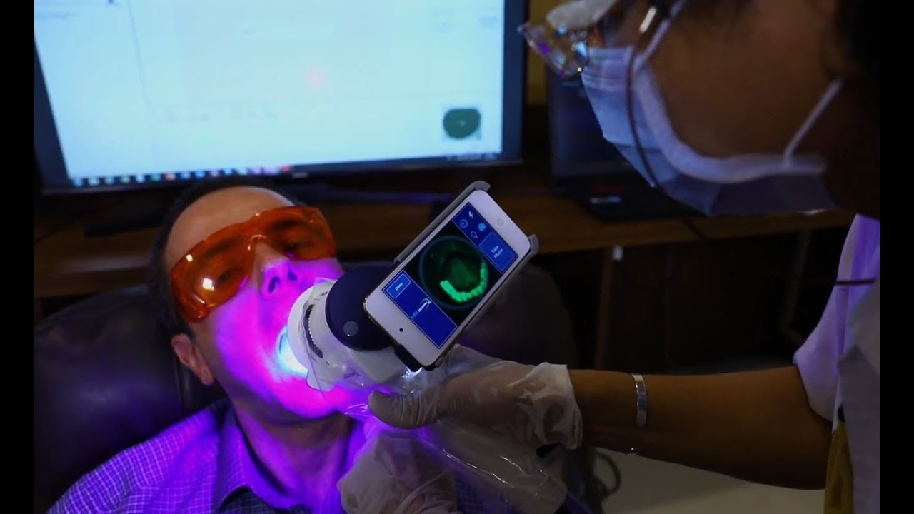 Dr Kolte - VELscan Oral Exam and DNAscan (DNA Ploidy Test) - YouTube