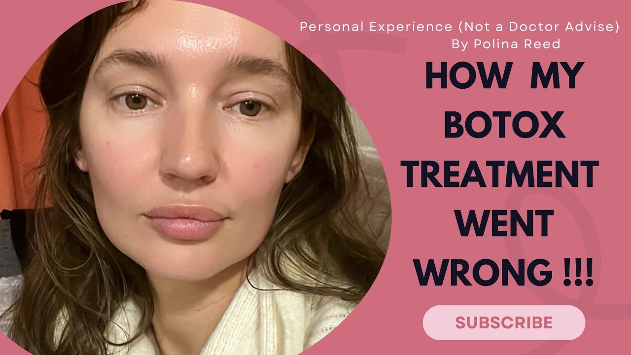 I PAID $2500 for My Botox Treatment - Turned Into Nightmare - Please ...
