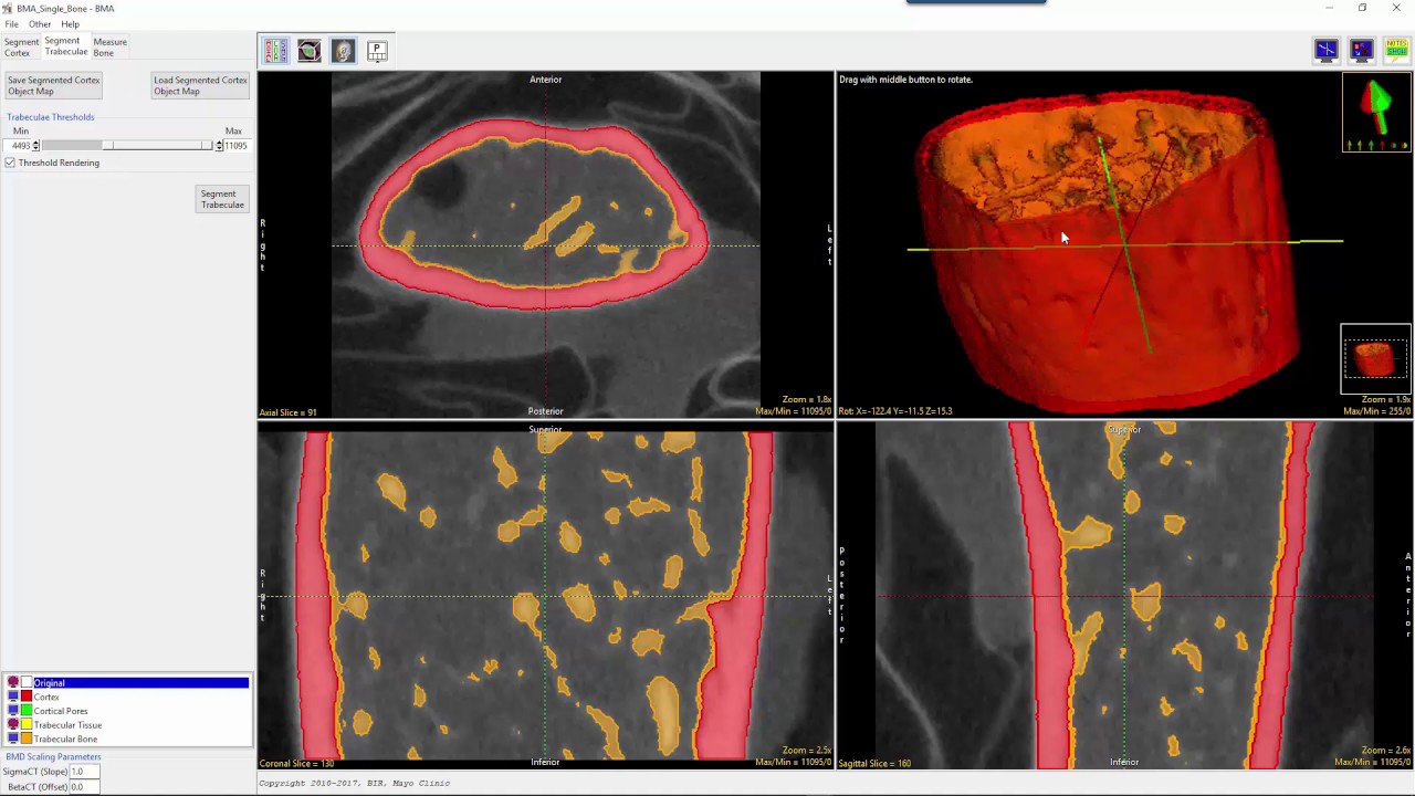 Analyze 14.0 - BMA: Bone Microarchitecture Analysis - YouTube