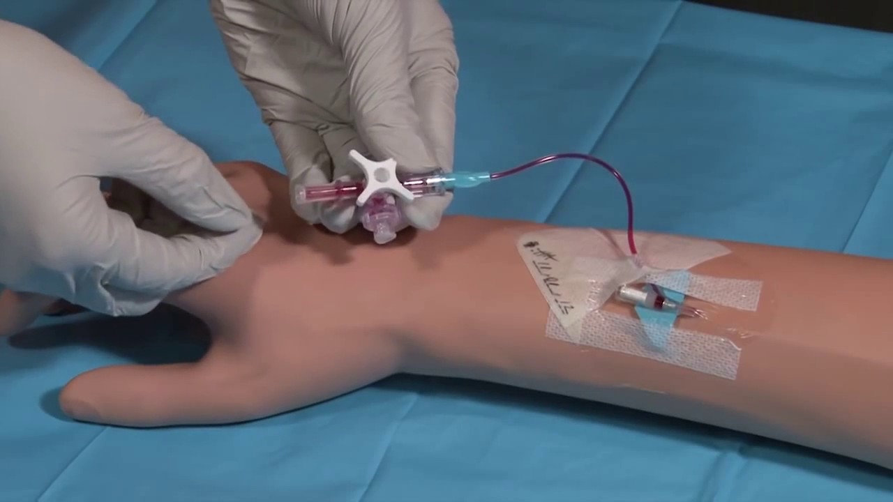 Becton Dickinson Nexiva IV System Review - YouTube