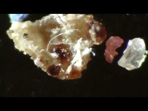 #152 - Morgellons New Found Greenish, Golden Micro Chip Crystals - YouTube