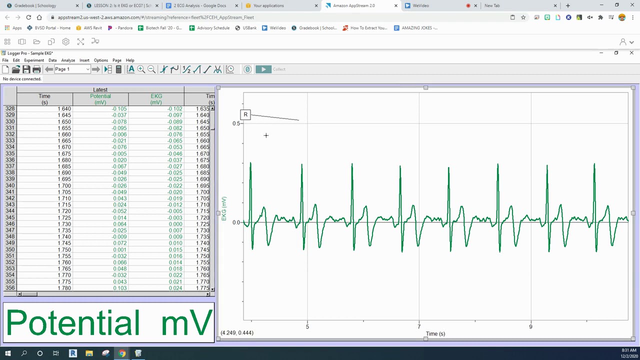 Labeling EKG - YouTube