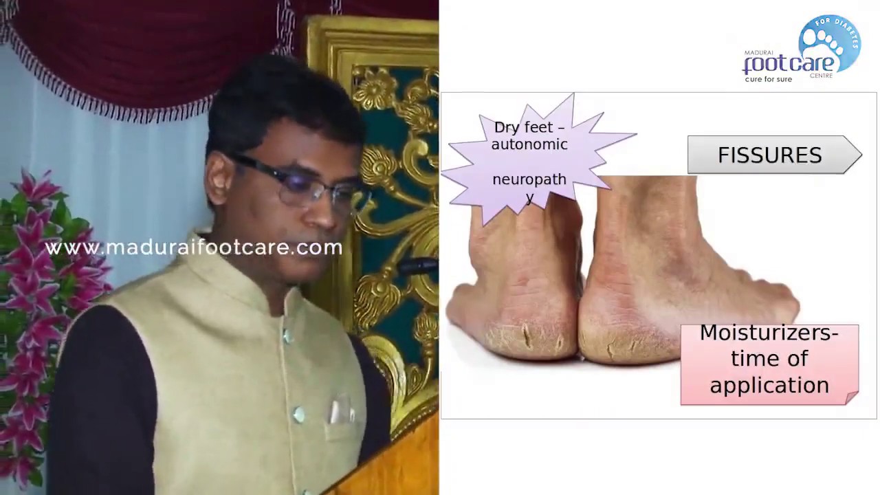 Prevention of Fissures on Foot - YouTube