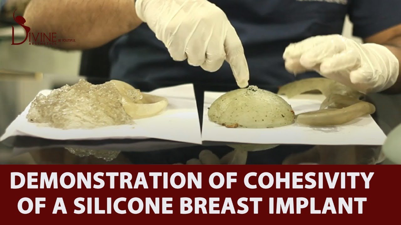 Demonstration Of Cohesivity Of A Silicone Breast Implant - YouTube