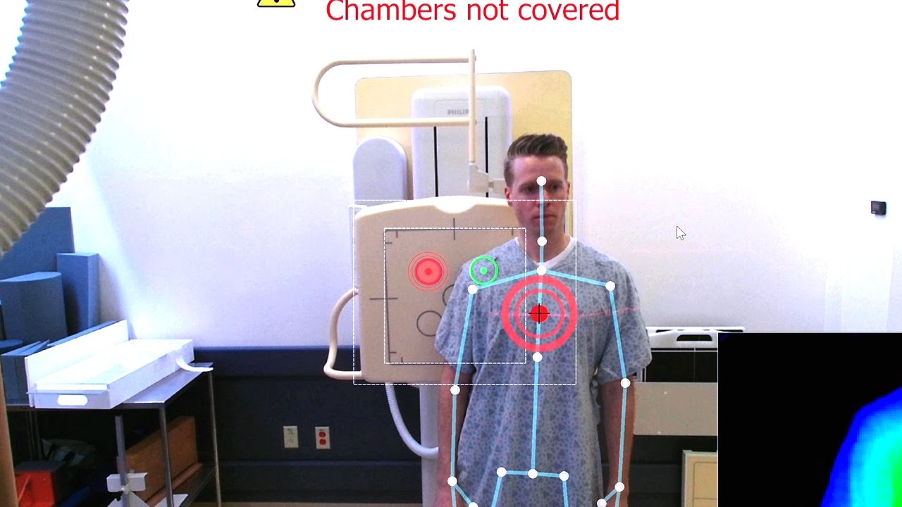 Xbox Gaming Technology May Improve X-Ray Precision - YouTube