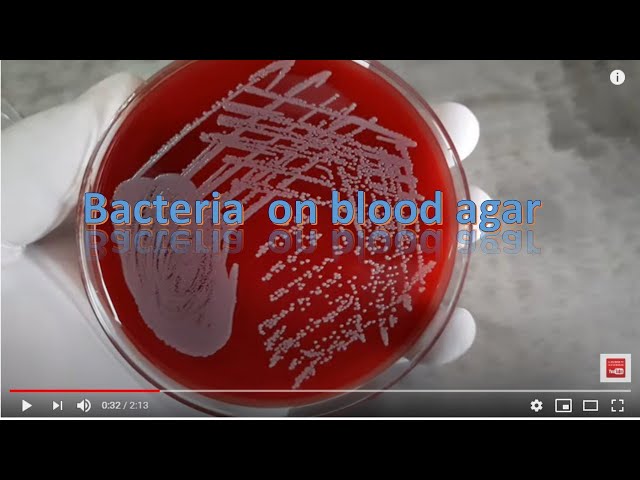 Blood Agar Staphylococcus Aureus